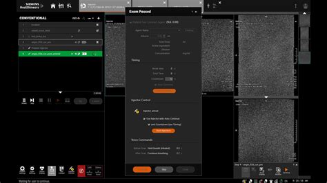 Mr Injector Coupling Via Imaging System Interface Isi 1 Siemens
