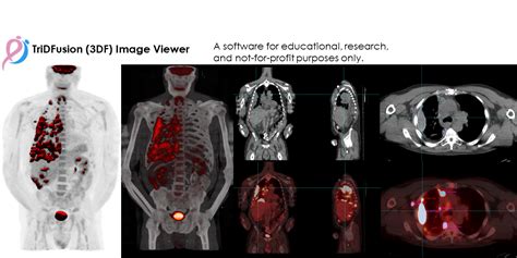 dicom viewer · github topics · github