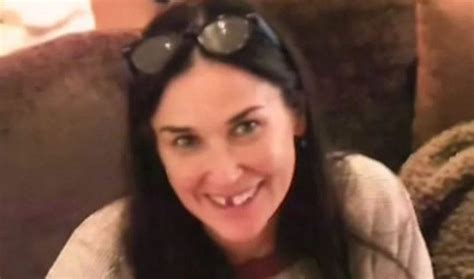 Demi Moore Reveals Stress Related Tooth Loss Uk