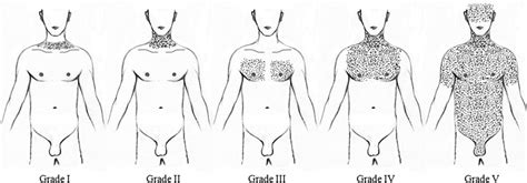 Classification For Severity Of Se Download Scientific Diagram