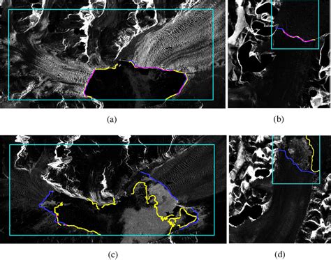 Visualization Of The Zone Segmentation Models Performance On The Test Download Scientific