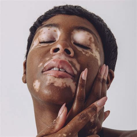 Get Your Skin Outs Good Skin Is Important Representation