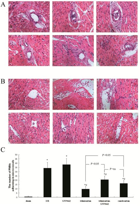 assessment of pmn adherence to microvessels by hande staining a