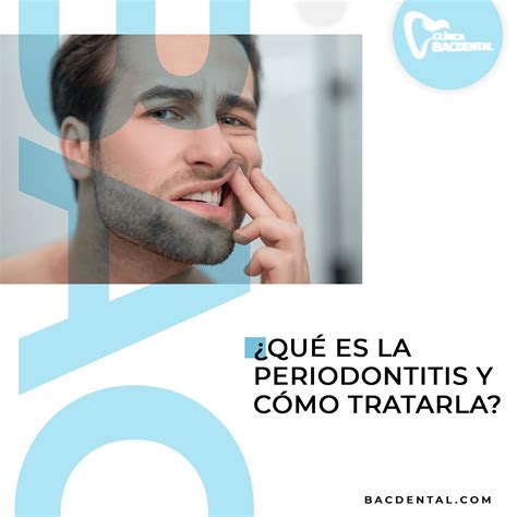 ¿qué Es La Periodontitis Es Una Clínica Bacdental
