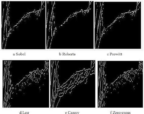 Figure 1 From Automatic Detection Of Liver Tumor Motion By Fluoroscopy