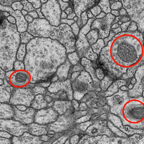 Computer Vision Opencv Image Segmentation Of Greyscale Image Stack