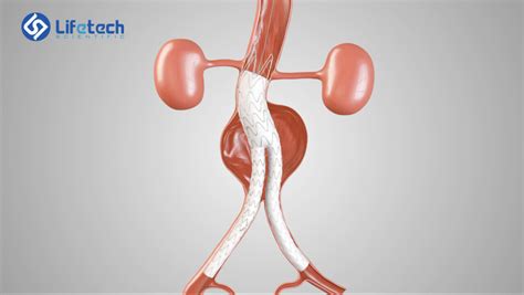 Raja Karthikeyan Posted On Linkedin