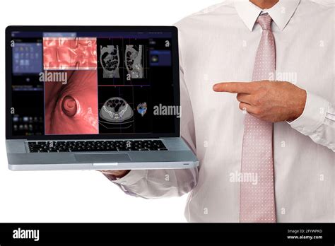 Doctor Working With Notebook Showing Ct Colonography Or Ct Scan Of