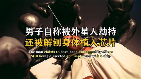 男子自稱被外星人劫持，還被解刨身體植入芯片，專家：他沒有說謊 紀中百事 古董 開棺 古墓 考古發現 Youtube