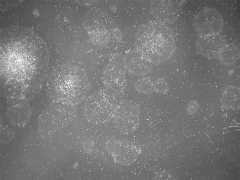 Ideal Confluence Of Cell Culture For Harvest Optimal Confluence Ranges Download Scientific