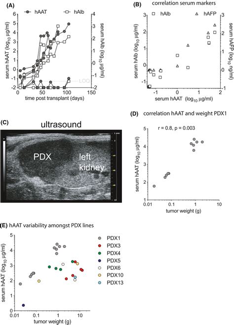 Human Aat Is A Serum Marker For Pdx Formation A After Implantation Download Scientific