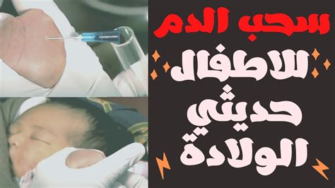 7طريقة سحب عينة الدم من الاطفال حديثي الولادة بكل سهولة Youtube