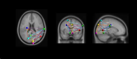 Brain Function Analysis Integrate Brain Health