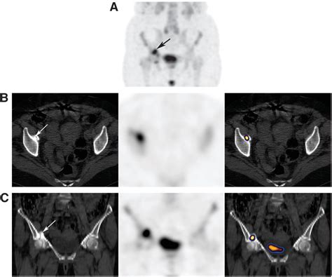 Figure 4 From Spect Multislice Low Dose Ct A Clinically Relevant Constituent In The Imaging
