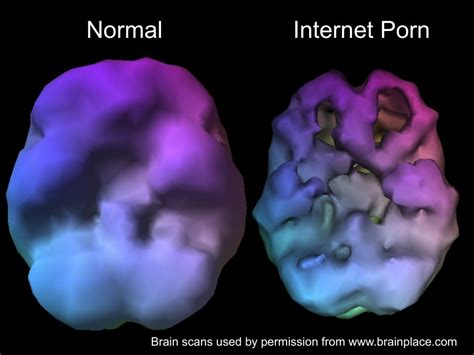 A Neuro Theology Of Sex And Addiction Shop New Hope Resources
