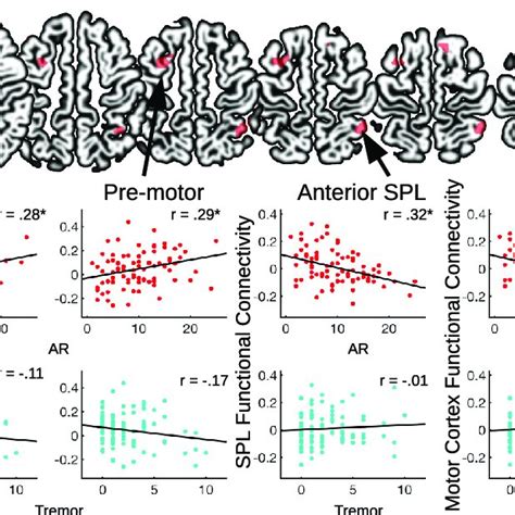 Motor Symptoms And Resting State Functional Connectivity Resting State
