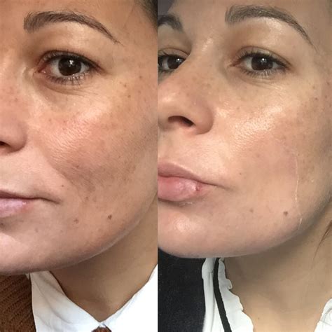 Mi Nueva Piel Twenty Seven Things