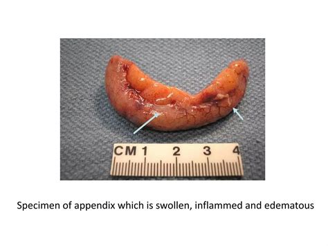 Surgical Pathology Specimens Pptx