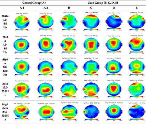 EC FFT Absolute Power Brain Mapping Download Scientific Diagram