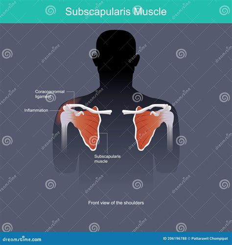 3d Illustration Of The Subscapularis Anterior Muscles On Xray