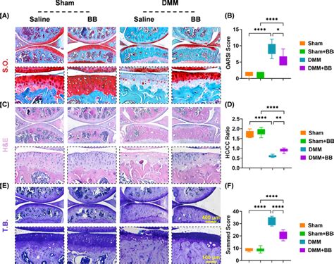 In Post Traumatic Mice Models Bilobalide Reduced Cartilage Erosion A