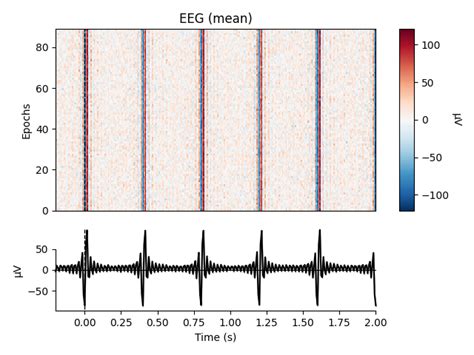 Recording Openbci At The Same Time Resolved — Openbci Forum