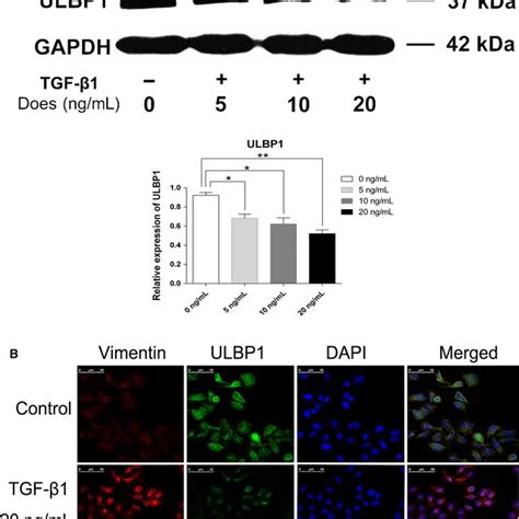 Three Epithelial‐mesenchymal Transition Subtypes Of Circulating Tumor Download Scientific