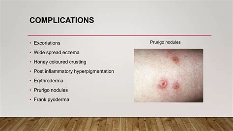Scabies Pptx Skin And Dermatology Diseases And Conditions