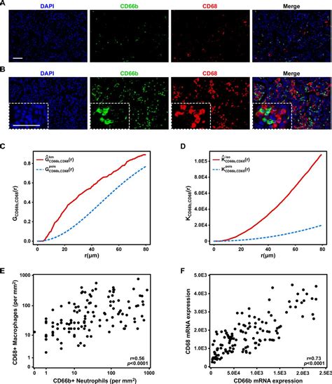 Tumor Associated Neutrophils And Macrophages Interaction Contributes To Intrahepatic