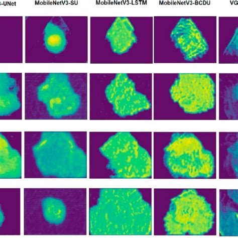 Class Activation Mapping Cam Of The Last Convolutional Layers Download Scientific Diagram