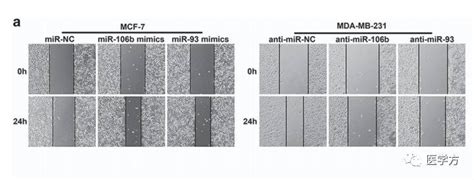 细胞划痕系列 结果分析