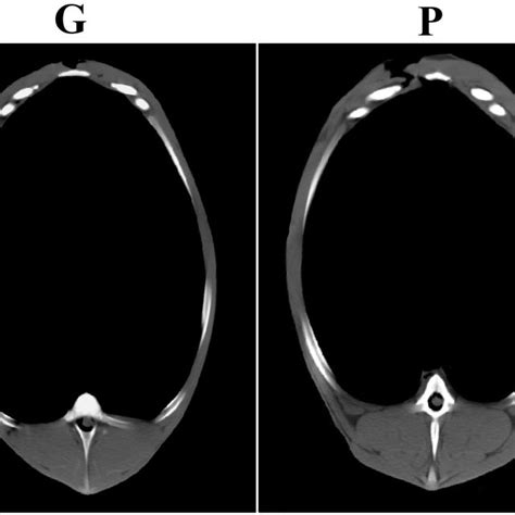 Cross Sectional CT Scan At Identical Anatomical Location At The Joint Download Scientific