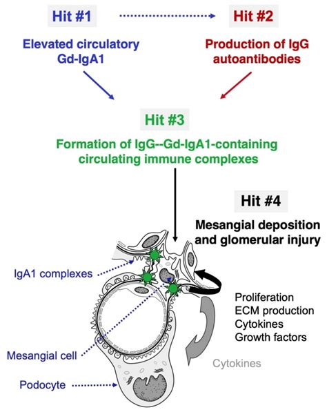 Pathogenesis Of Iga Nephropathy Current Understanding And Implications For Development Of