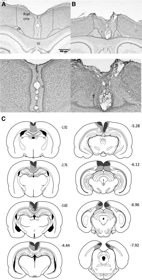 A Novel Role For The Rat Retrosplenial Cortex In Cognitive Control Abstract Europe Pmc
