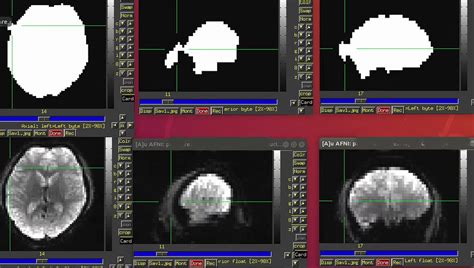 get the brain mask using 3dautomask afni message board afni discuss