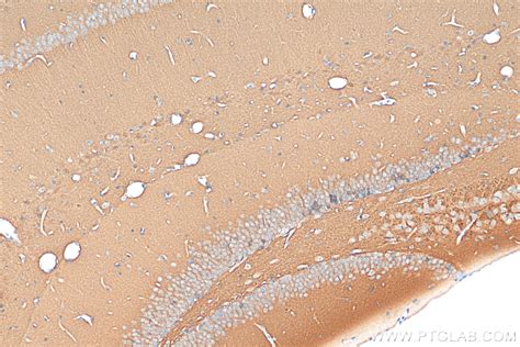 Psd95 Antibody 30255 1 Ap Proteintech