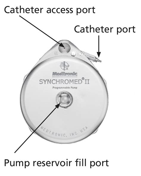 Intrathecal Baclofen Leeds Teaching Hospitals Nhs Trust