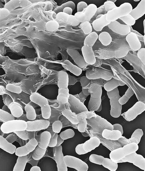 Acinetobacter Baumannii Sem Stock Image C037 0152 Science Photo Library