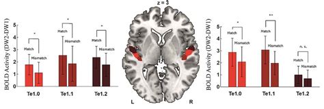 Effects Of Matching Clear Pseudowords On Degraded Pseudoword Bold Download Scientific Diagram