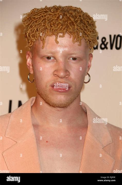 Black Albino Model Shaun Ross