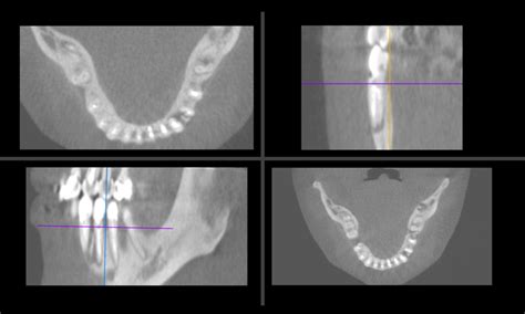 Cone‐beam Computed Tomography Scan Download Scientific Diagram