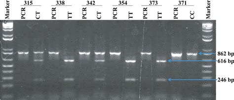 Restriction Enzyme Digestion Pattern Of Hsp70‐hom 2437