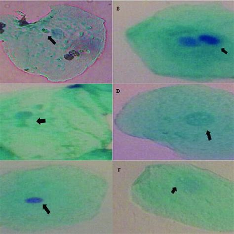 Morphological Damage Arrows Of Buccal Mucosal Smear Stained With