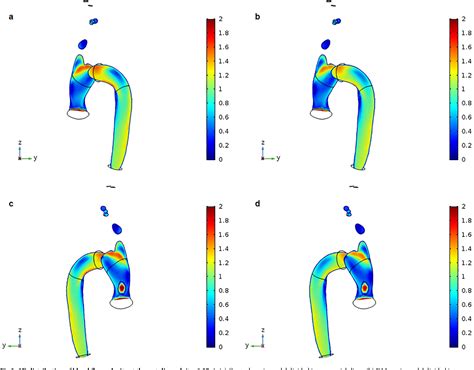 Figure 2 From Hemodynamics In Diabetic Human Aorta Using Computational Fluid Dynamics Semantic