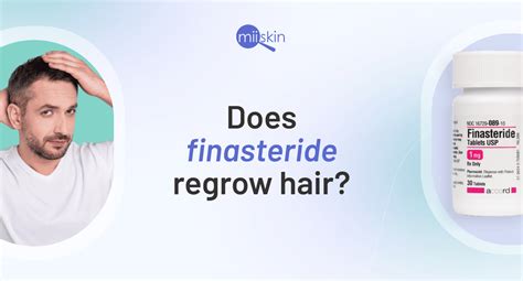 Can Finasteride Regrow Hair