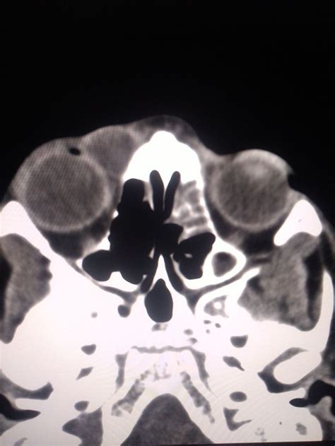 Pin Su Radiology Interesting Cases And Spotters