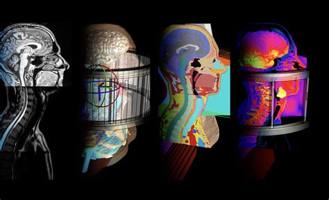 Multiphysics Cae Simulation Platform Wireless Device And Antenna Design High Resolution