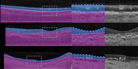 Example Segmentation Outputs From The R2 U Net 3 Layer Variant For Download Scientific