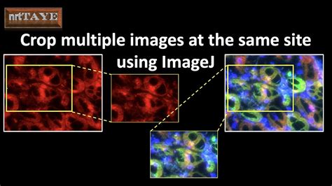 Summary Of How To Set Scale Bar Using ImageJ Software Microscope