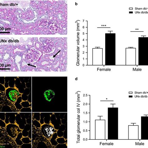 increased glomerular volume and glomerulosclerosis in unx db db mice